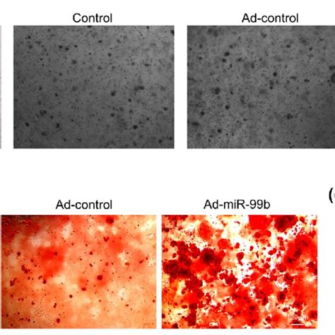 Mir 99b Can Significantly Promote The Osteogenic Differentiation Of Download Scientific Diagram