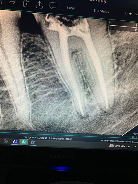 dr mahmoud nader posted on linkedin