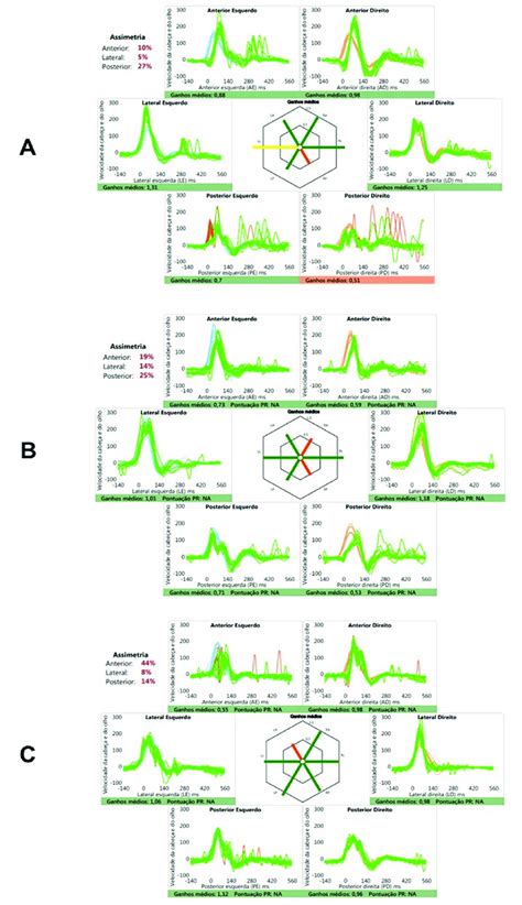 Video Head Impulse Test Recordings After Head Impulses In The Plane Of