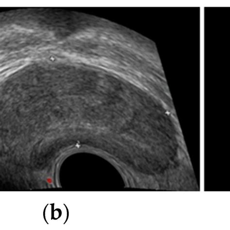 Effect Diagram Of Shear Transformation A Is The Original Image B