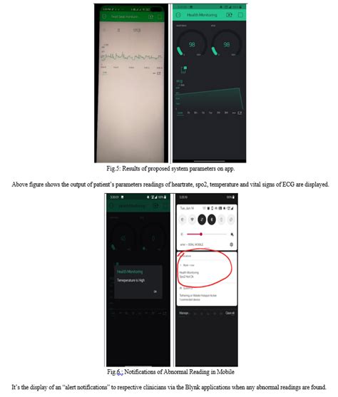 An Application For Monitoring Pregnant Women Using IOT
