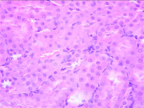mitoses and apoptosis in the proximal tubules of the renal cortex