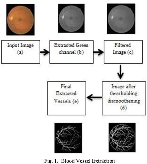 figure 1 from fuzzy c means based feature extraction and classification