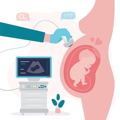 Ilustración De Concepto De Detección De Embarazo Por Ultrasonido