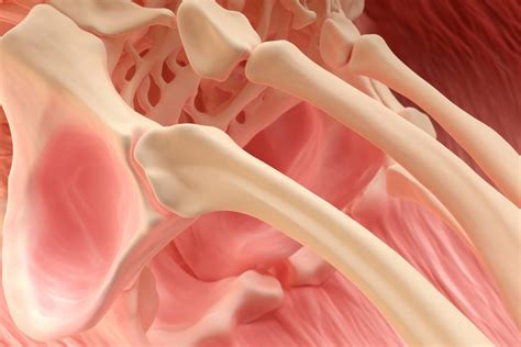 Is The Labrum Removed During Hip Replacement Hip Knee Orthopaedics