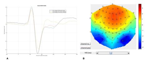 Figure 1 From Multimodal Integration Of Meeg And Fmri Data In Spm12