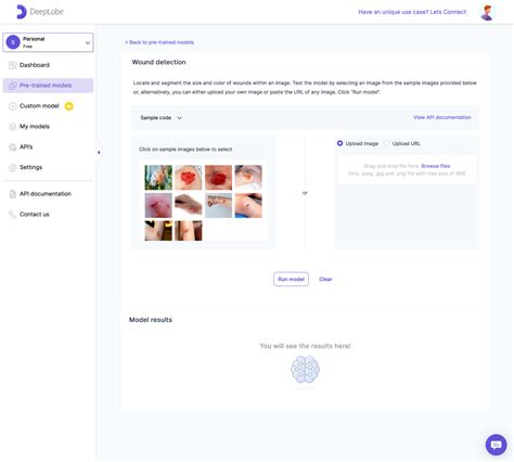 Wound Detection Model Deeplobe Help Documentation