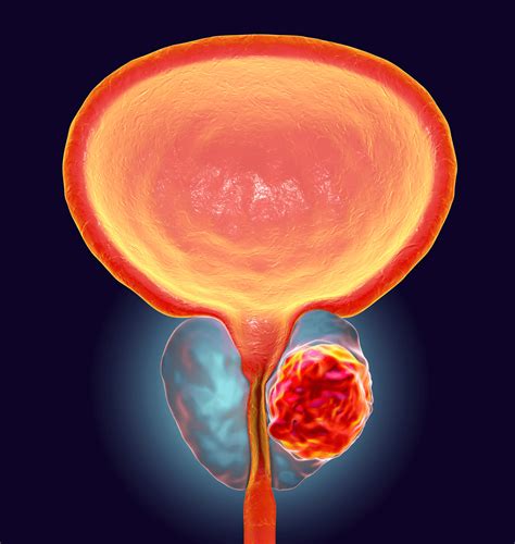 Prostate And Bladder Ultrasound Scan Medical Room