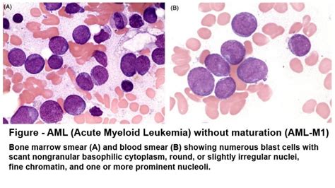Periodic Acid Schiff Pas Staining Principle Procedure Result Uses Biology Notes Online