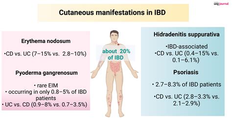 Pyoderma Gangrenosum Ibd