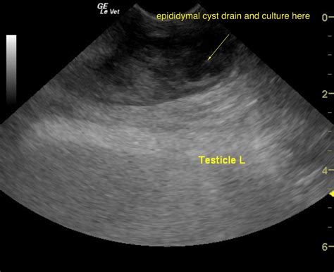 09 00156 Jack O Epididymitis And Prostatitis Members