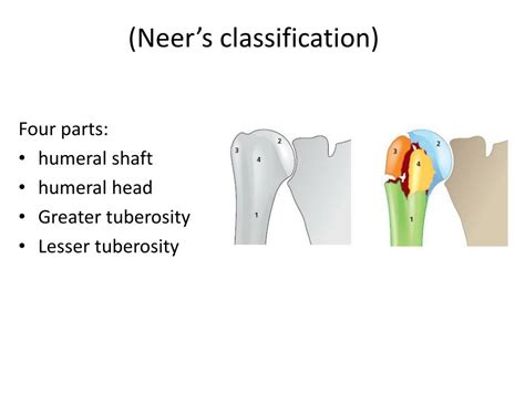 Ppt Common Adult Fractures Powerpoint Presentation Free Download Id2122118 Ppt Common Adult Fractures Powerpoint Presentation Free Download Id2122118