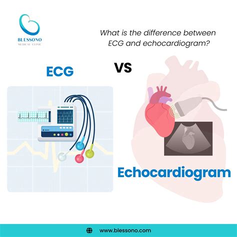 What Is The Difference Between Ecg And Echocardiogram Blessono Health Blog