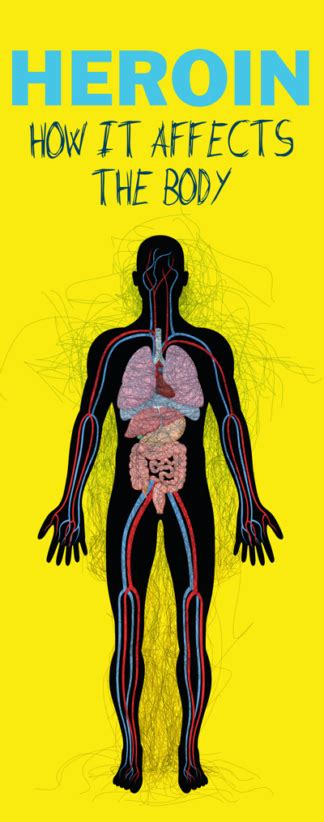 Pamphlets And Brochures Prevention And Treatment Resources