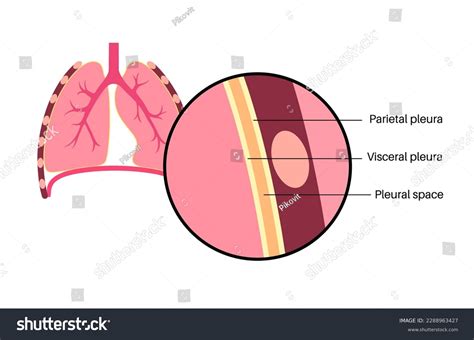 Mediastinal Pleura Cadaver