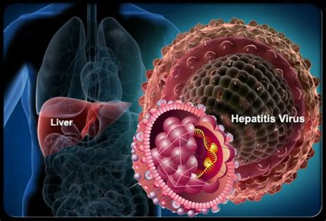 Perjalanan Penyakit Dan Pengobatan Hepatitis B Hepatologi Caiherang