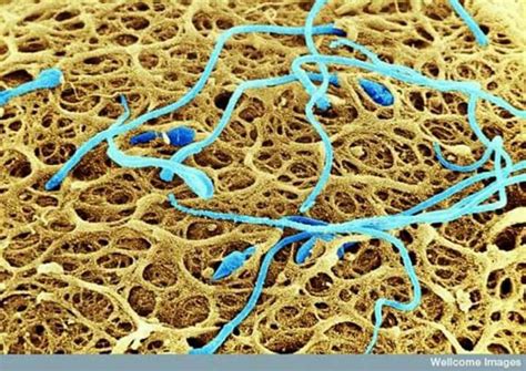 Espermatozoides y óvulo en proceso de fecundación vistos bajo un microscopio electrónico de