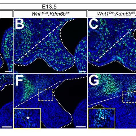 Edu And Runx2 Cells Are Restored In Wnt1 Cre Kdm6b Fl Fl Ezh2 Fl