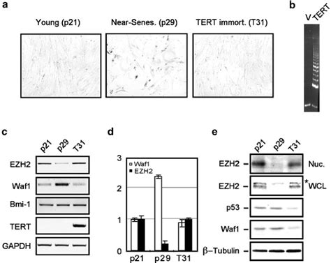 Activated P53 Suppresses The Histone Methyltransferase Ezh2 Gene Oncogene