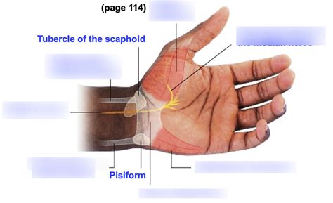 Diagram Of Orientation Of Median Nerve In CT Palmar View Wk3 Quizlet