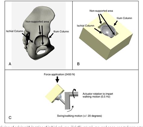 Figure 1 From The Effects Of Acetabular Shell Deformation And Liner Thickness On Frictional