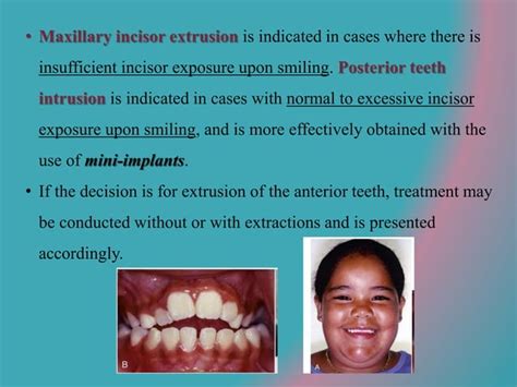 Elastics For Open Bite Treatment Pptx