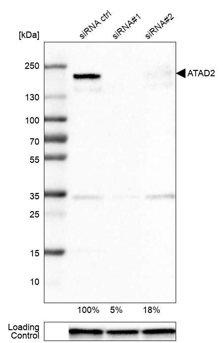 Mouse Monoclonal Anti Atad2 Antibody Buy For Research Highly Specific Rigorously Validated