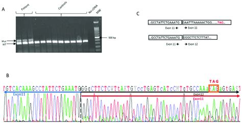 Palb2 Exon 11 Duplication Disrupts Normal Splicing And Leads To Download Scientific Diagram
