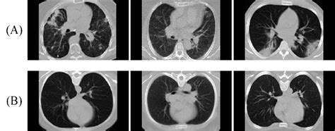 Histogram Of Predicted Values By The Network Colored Based On The True Download Scientific