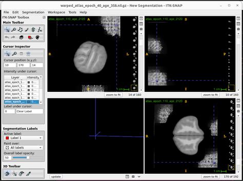 Patches Of Noise On The Edge Of The Generated Atlas Images Issue 3