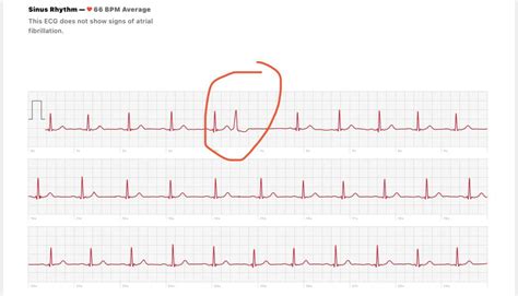 Does This Look Like A Pvc R PVCs
