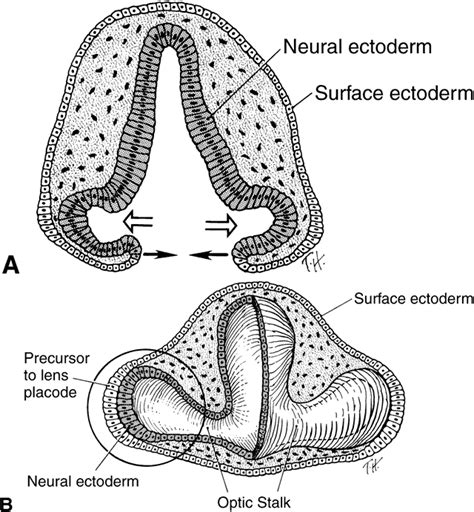 Lens Placode Embryology Pathology Ento Key A Thickened Portion Of Ectoderm Which Serves As