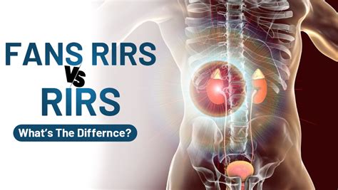 FANS RIRS Vs RIRS Whats The Differnce The CureStone