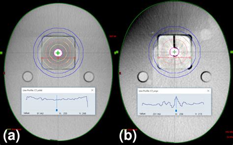Axial Profile Variation In Ct Hounsfield Hu Value A Ct Image In The Download Scientific