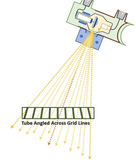 Grids And Beam Restriction Digital Radiographic Exposure Principles And Practice