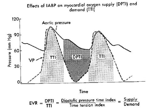 Iabp Principle Hemodynamic Timing Weaning 2016 Background Asmiha