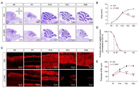 O-GlcNAcylation Is Required for the Survival of Cerebellar Purkinje ...