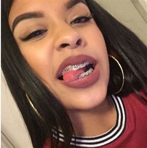 Follow Me For More Poppin Pins Uel Ibekwe 💋 Brace Face Cute Braces