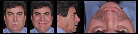 Discover The Evolution Of Smile Design Techniques A Comprehensive