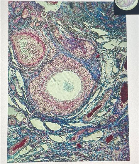 Solved What Part Of A Cat Ovary Is This