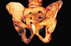 Solved Part One Determining SexWe Will Begin By Looking At Chegg Com