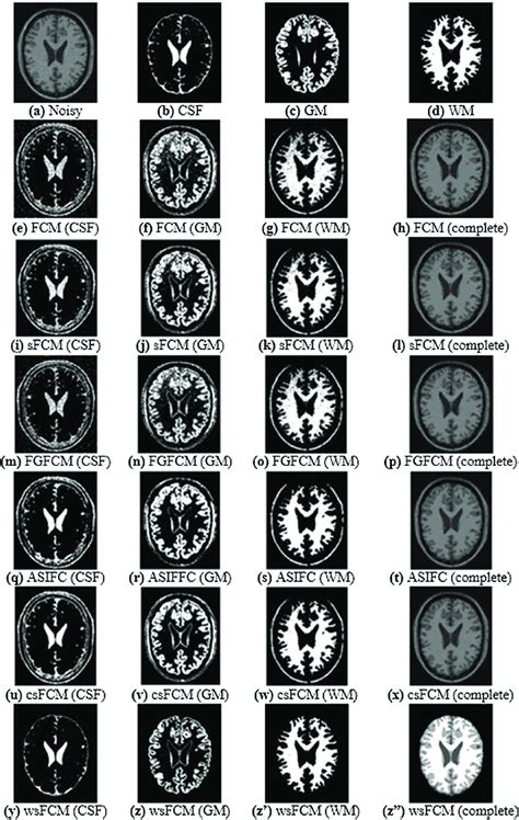 sample segmentation results of csf gm wm against state of the art