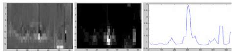 Left Symmetry Decomposition Map For 15 Grey Levels Of A 65 Slices