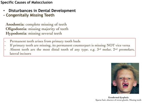 Known Causes Of Malocclusion Pdf