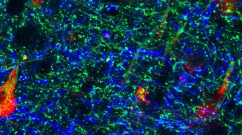 Aldridge Lab The University Of Iowa