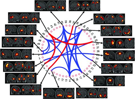 functional connectivity analysis result for first 10 seconds