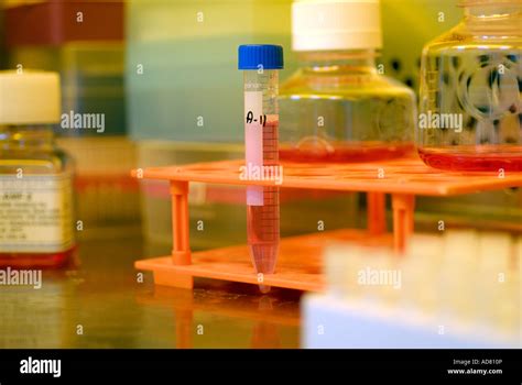 Amniotic Fluid Sample