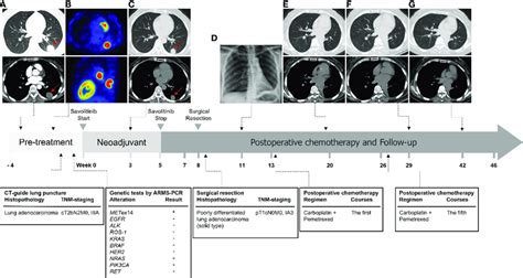 timeline of diagnosis and treatment of this case a the chest