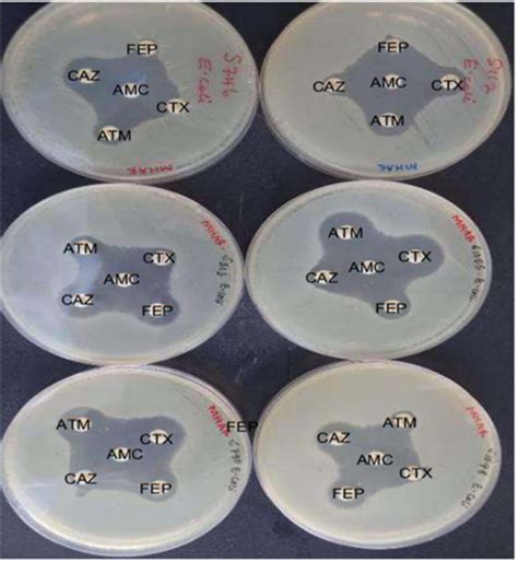 Modified Double Disc Diffusion Test Results Download Scientific Diagram