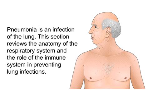 Pneumonia